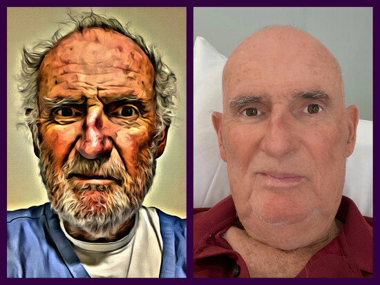 When will my hair grow back? by John Falconer · 365 Project